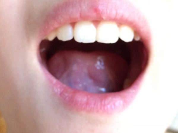 How to teach initial R in 10 easy steps! - Super Power Speech