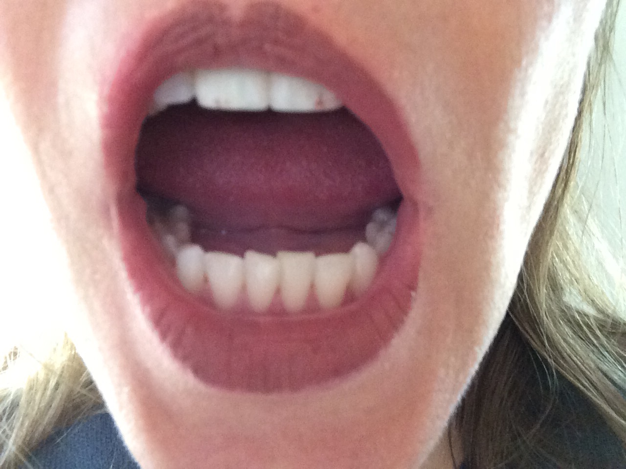 How to teach initial R in 10 easy steps! - Super Power Speech